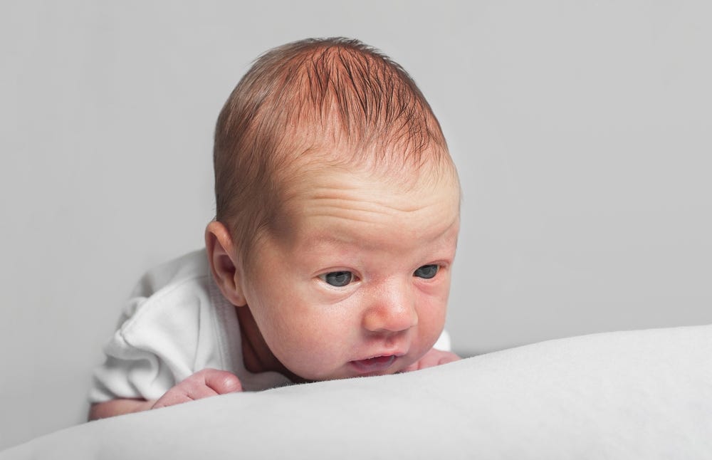 Pediatric Pearls. Infant's Skin - Head / Scalp