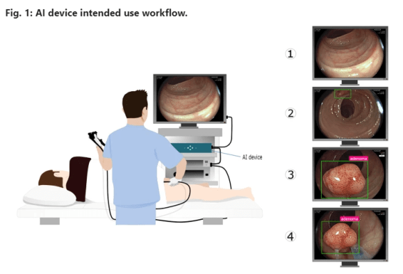 AI and physicians as “thought partners”: a use case in endoscopic ...
