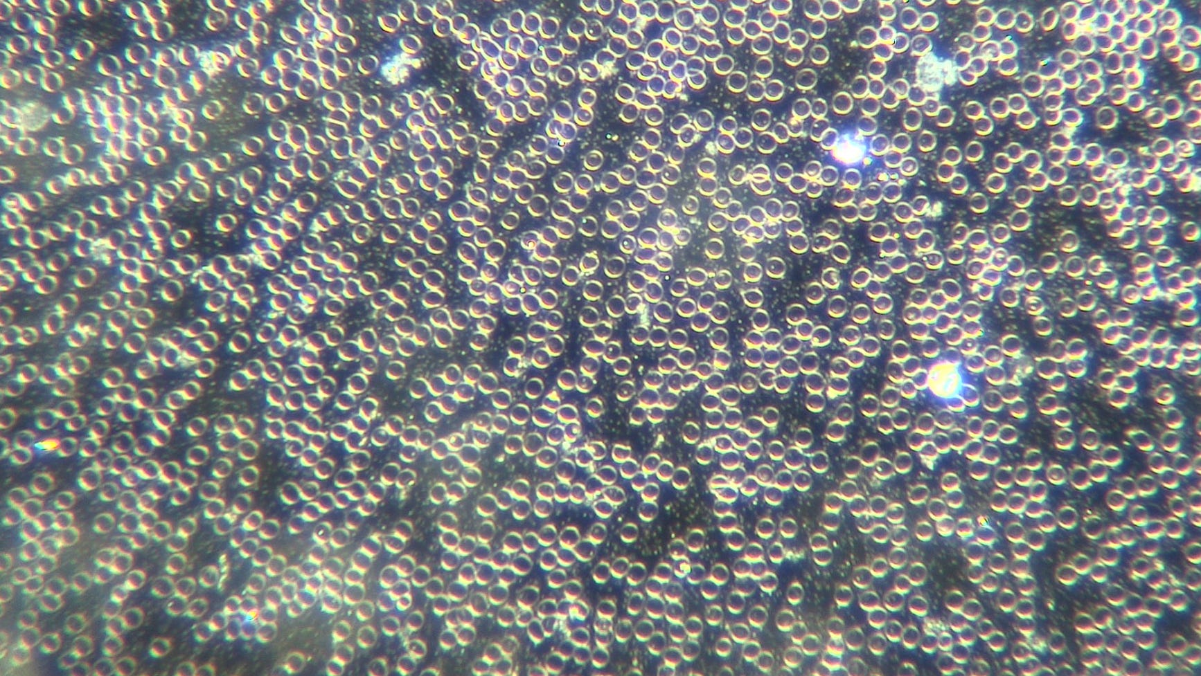 Plaquex Effects On Live Blood Oxidative Stress Affected By Self ...