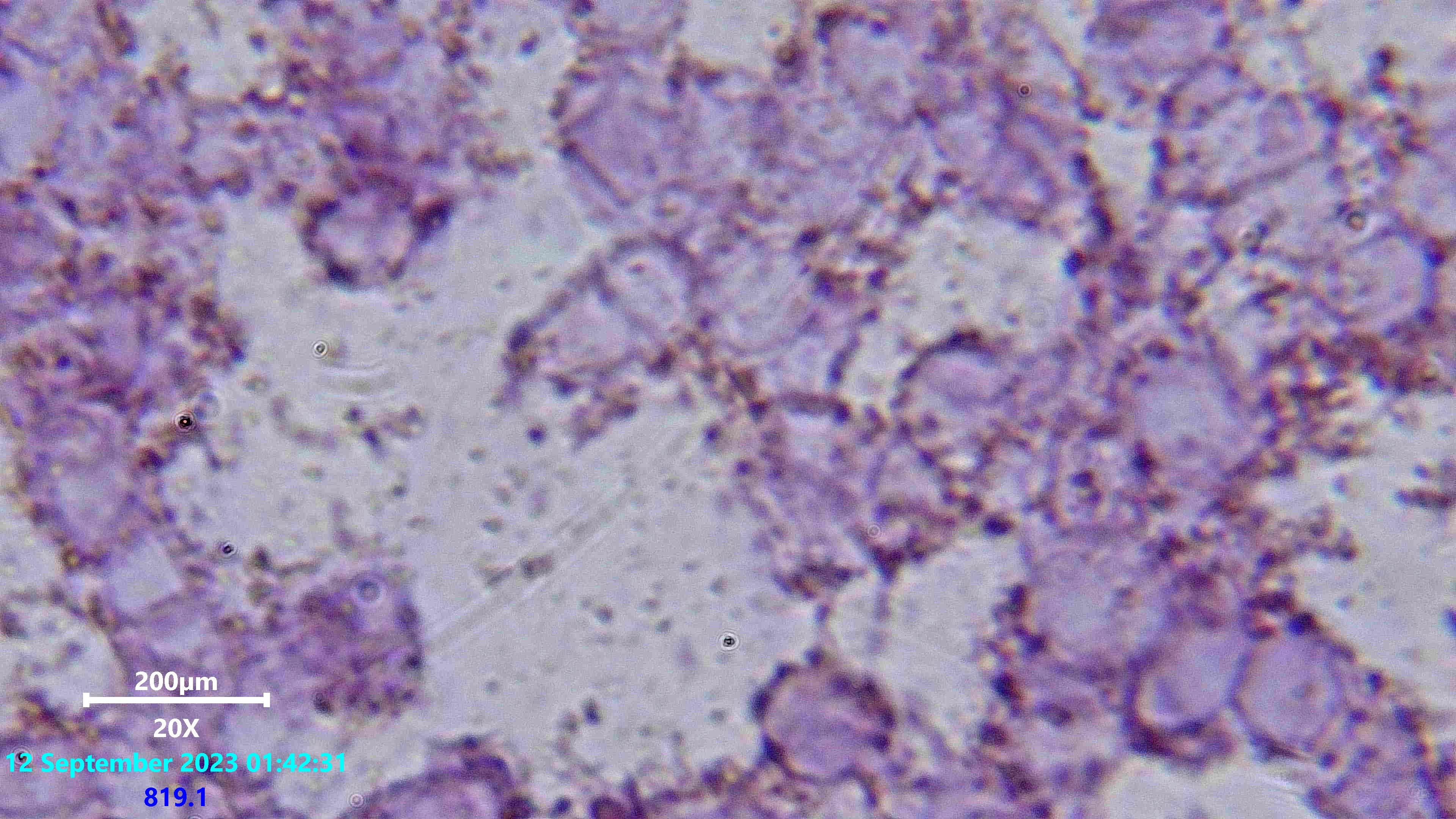 Gram staining of my blood reveals same abnormalities shown by ...