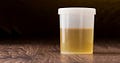 Ancient Romans Brushed Their Teeth with Urine