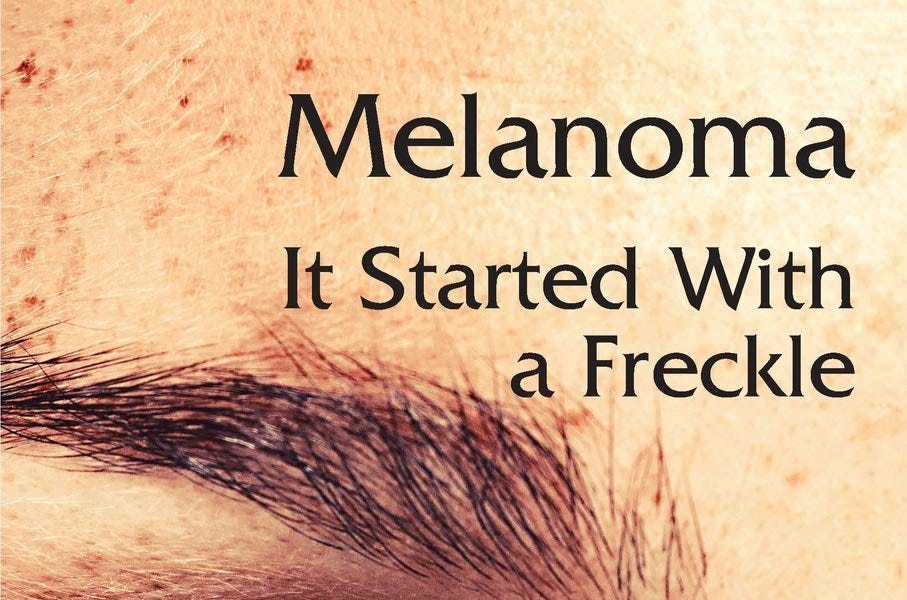Melanoma; it Started with a Freckle - by David Stanley