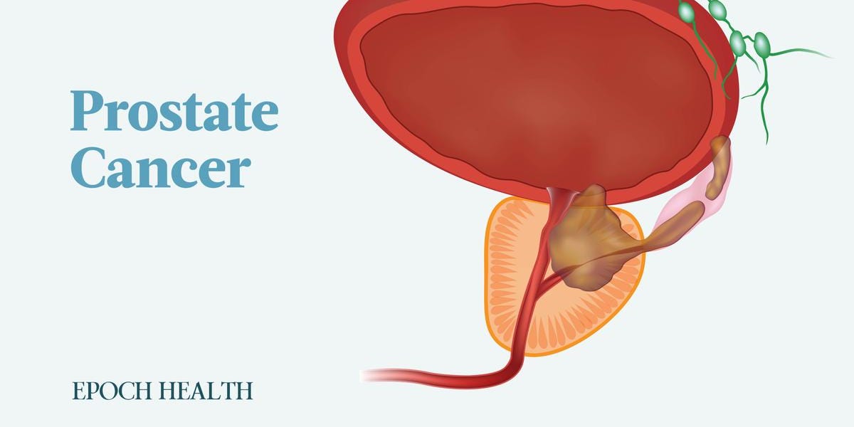 Prostate Cancer: Symptoms, Causes, Treatments, and Natural Approaches