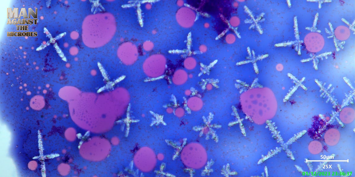 WoW! Staining of the swab solution show amazing chemical transitions ...