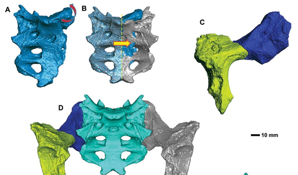 The Pelvic Anatomy of DNH 43: A Window into Hominin Evolution