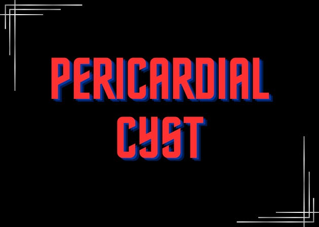 What Is A Pericardial Cyst? - The Echo Journal