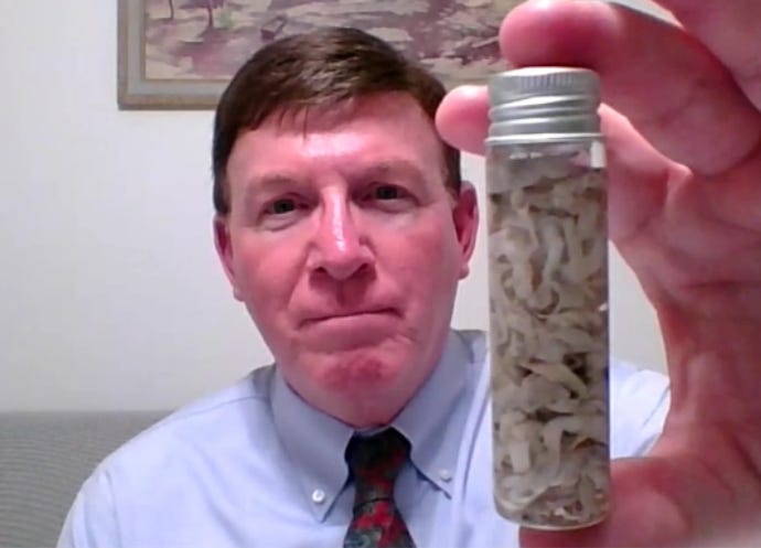 Tom Haviland: White Fibrous Clots from CV19 Vax, CONTAGIOUS