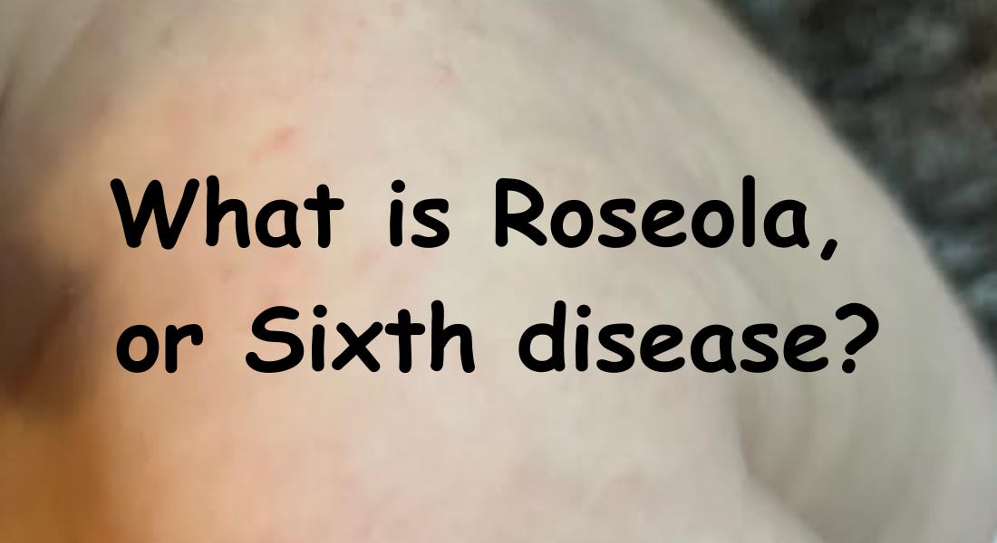 Roseola, or Sixth disease - by Robert Herriman