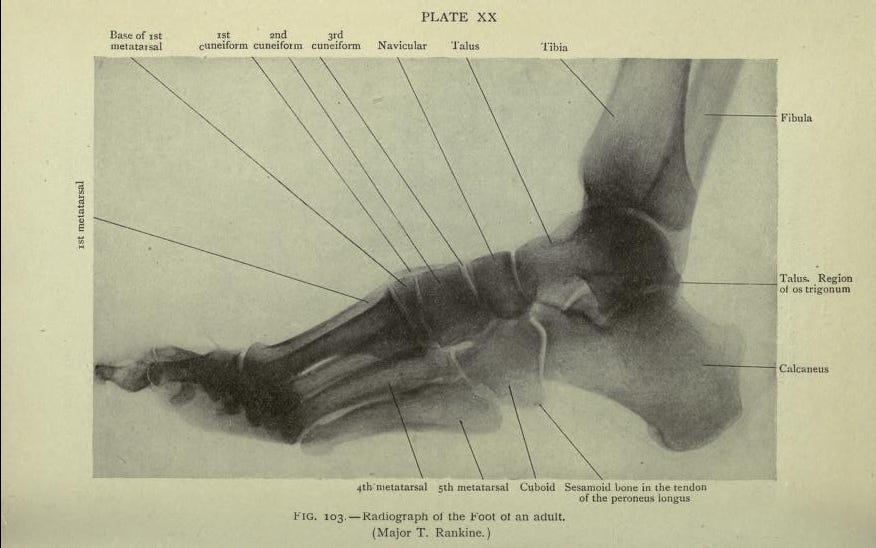 TikTokers are dropping heavy objects on their feet for views