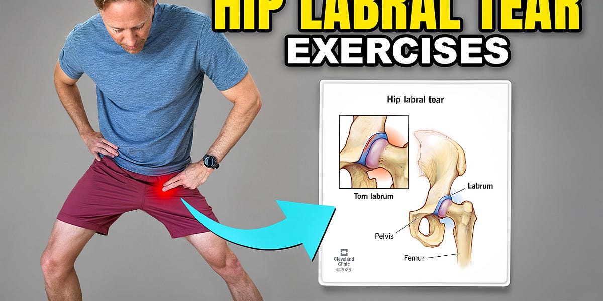 Hip Labral Tear Rehabilitation - by Dr. Tom Walters