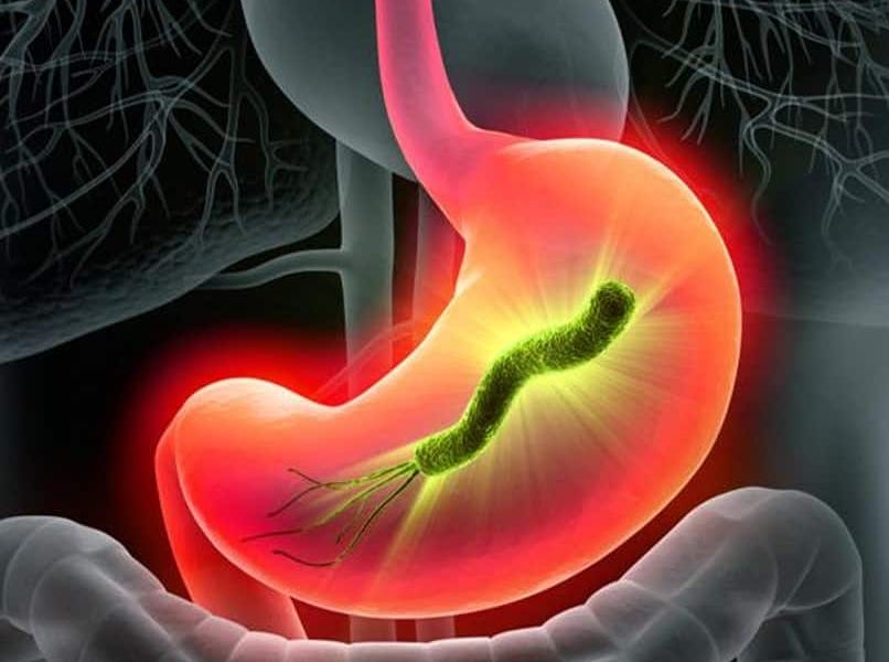 H. Pylori Bacteria and Nutrient Malabsorption