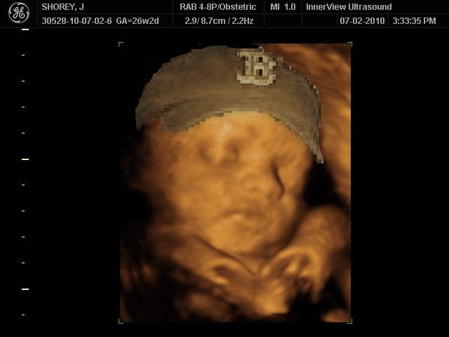 A Masters Eve Apology - by Adam Shorey - Apropos of Nothing