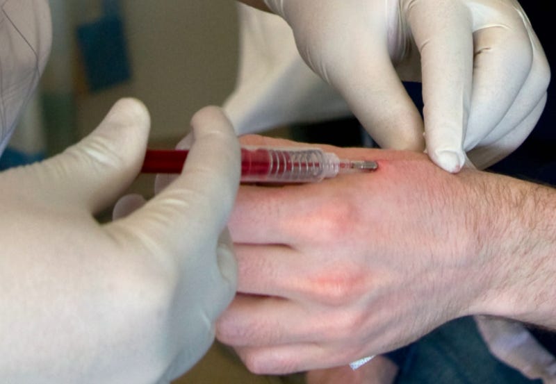 Under-the-Skin Surveillance - by Jared Brock - Future Faith