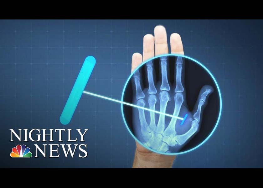 Human Microchip Implants and the Internet of Bodies