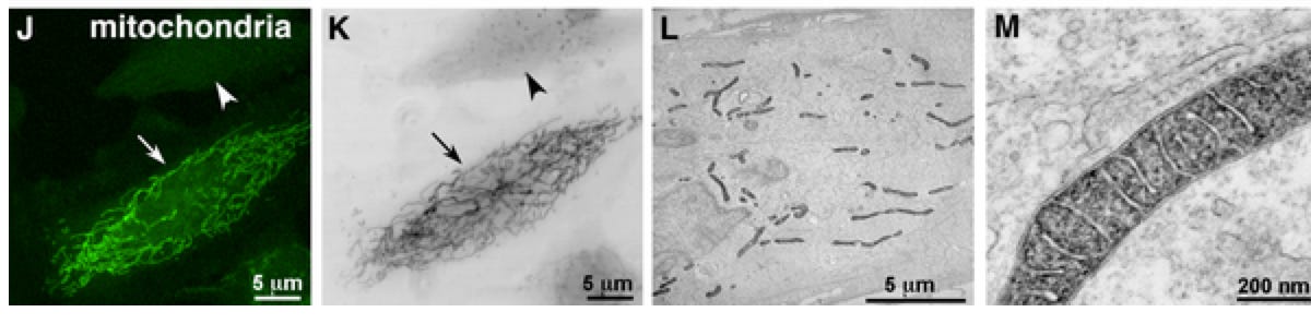 MiniSOG, a light and electron microscopy fusable marker