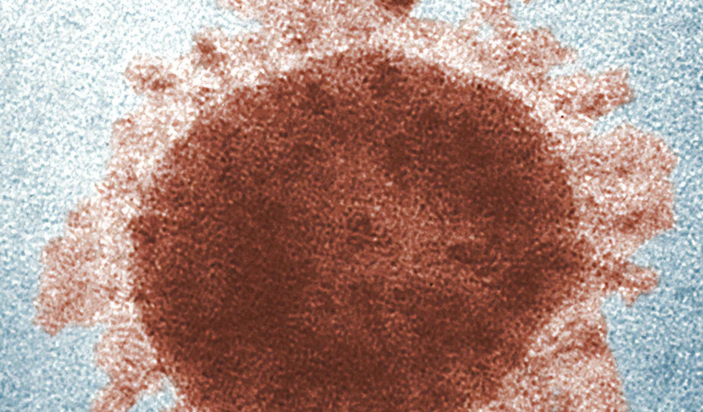 Boost or bust - by Merrill Goozner - GoozNews