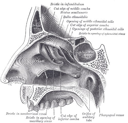 Referred pain from the sphenoid sinus - by Gavin Giovannoni
