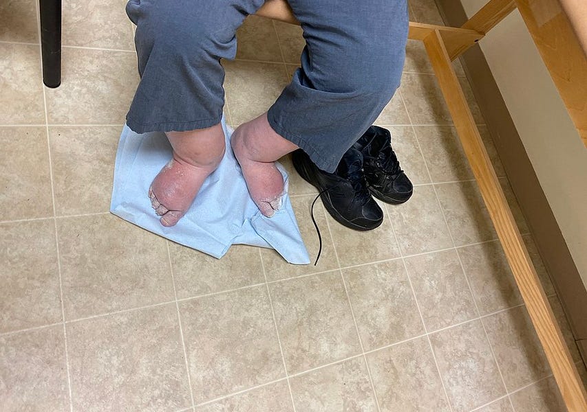 Only 1% of Heart Failure Patients Receive Optimal Medical Therapy at Appropriate Doses