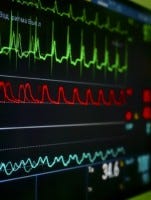 Vasopressors for septic shock - by ... - PulmCCM