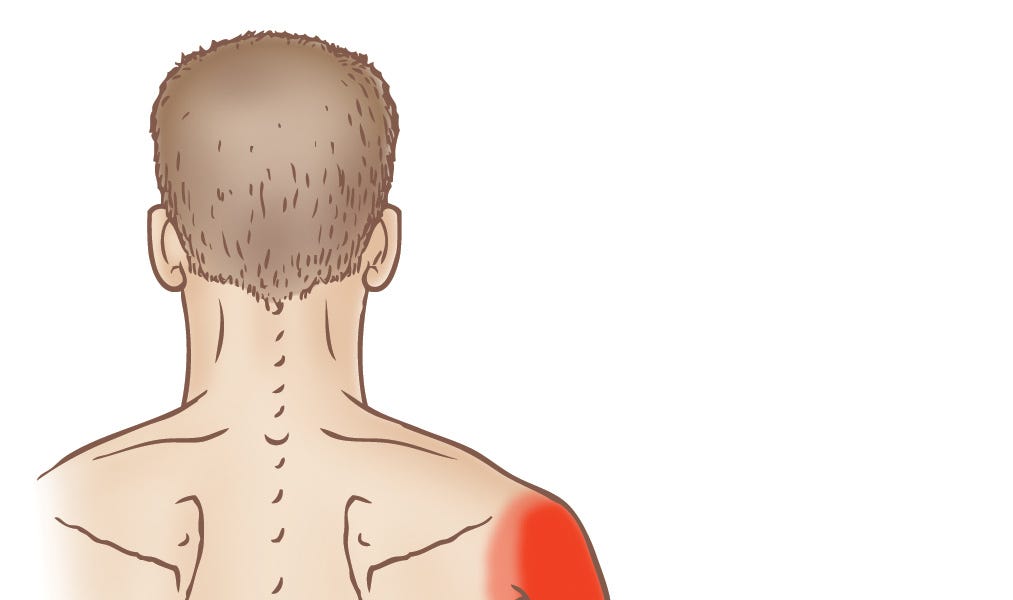 Teres Major - by The Anatomy of Therapy - Rebuild Yourself