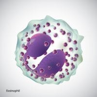 Reslizumab (CINQAIR) worked as add-on treatment for severe asthma with ...