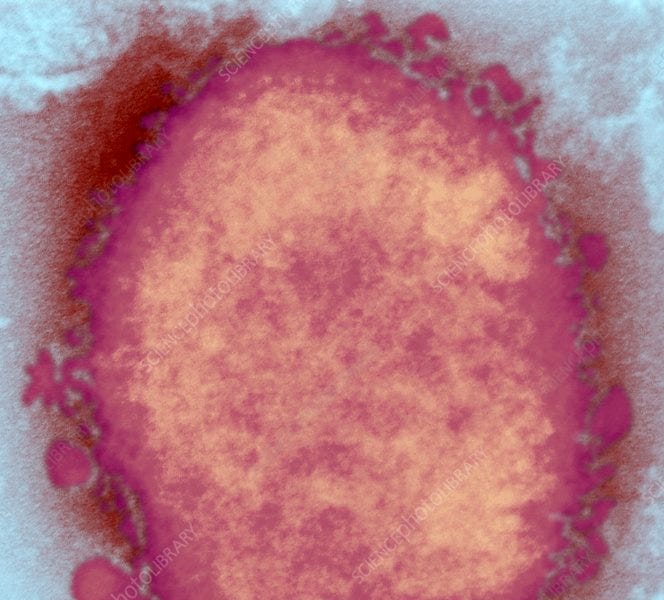 The Latest Pox On Our Houses - All Facts Matter