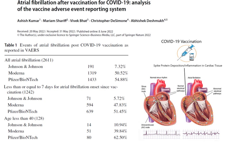 Atrial Fibrillation after COVID-19 Vaccination
