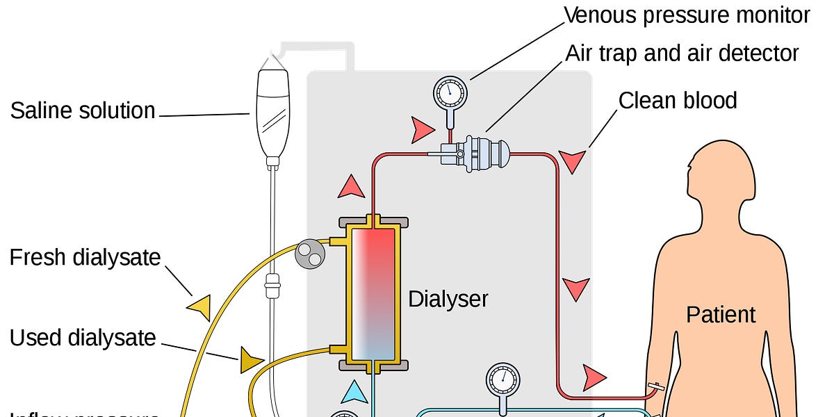 Kidney Failure and the Dialysis Industry