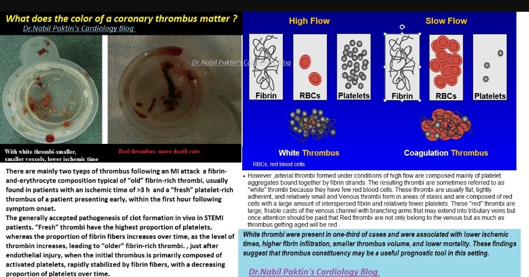 Leukocyte-Platelet Rich Fibrin: White Clots