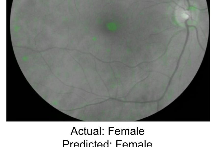 The amazing power of "machine eyes" - by Eric Topol