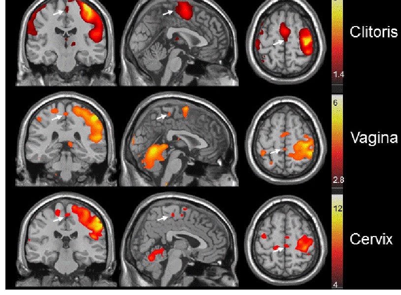 Neuroscience Reveals the Parts of the Brain Responsible for Sexual ...