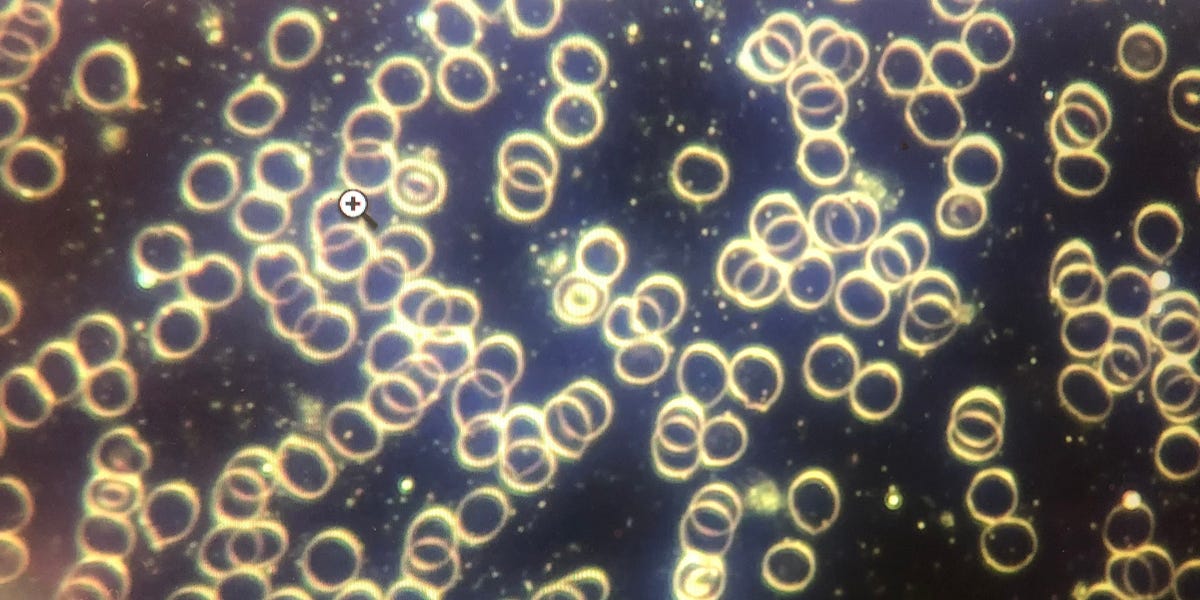 "There Is Hope—EDTA Chelation Works," Writes Dr. Ana Maria Mihalcea ...