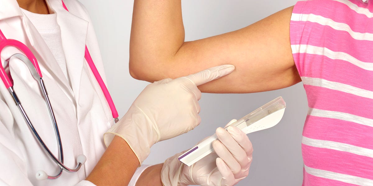 The Nexplanon and Menopause. How will I know?
