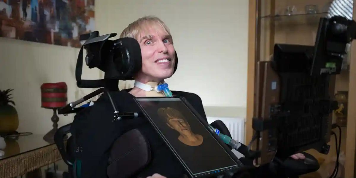 The Profile Dossier: Peter Scott-Morgan, the Human Cyborg