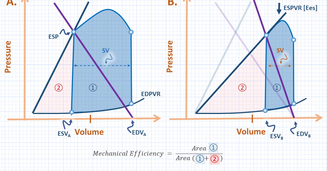 ICU Physiology in 1000 Words: Venous Doppler & Veno-Cardiac Coupling ...
