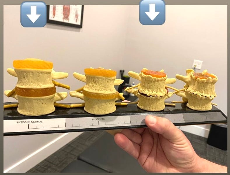 Muscle armoring - by Karen Sargent - Grace and Therapy