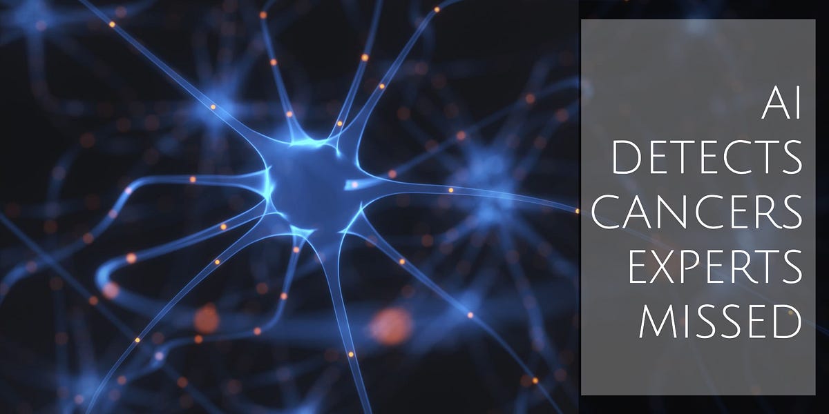 Weekly AI Roundup - AI detects cancers that experts missed