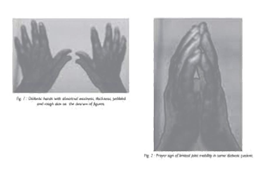 Clap - by H. - Gloriole