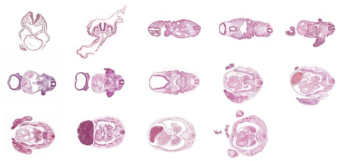 High resolution transverse sections for each stage CS10 to CS23