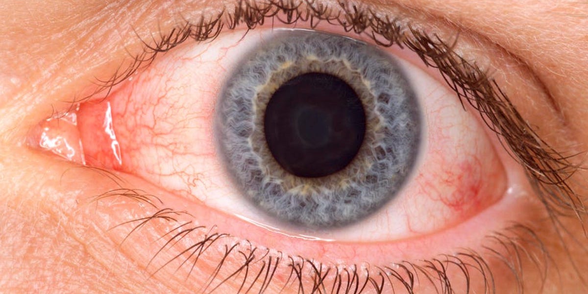 They're Doing It AGAIN - The Push for "COVID-23" Is Here...