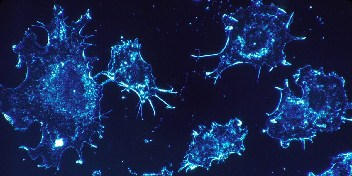 What NIH Layoffs Mean for Cancer Patients