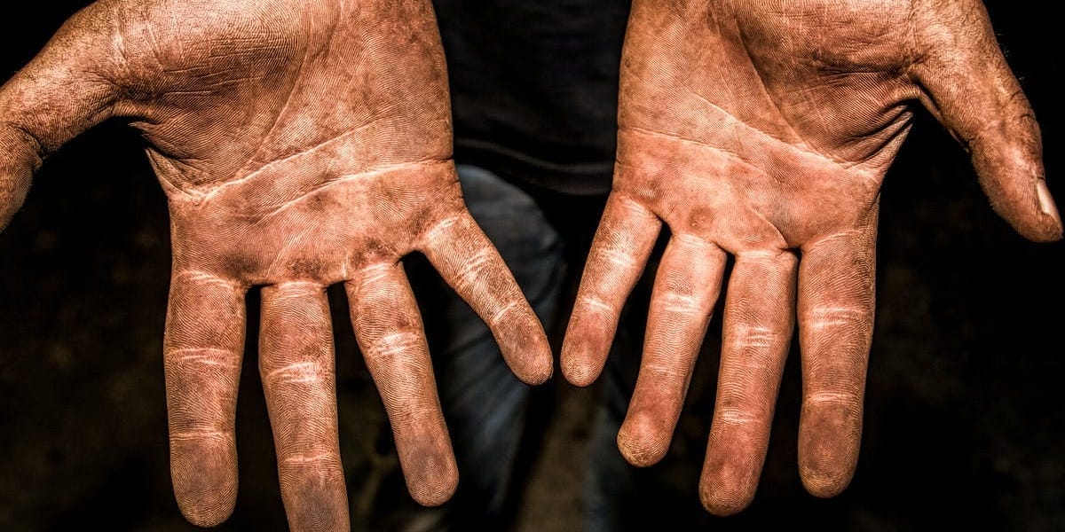 Reproving the Germ Theory with the Terrain Theory Model of Diseases