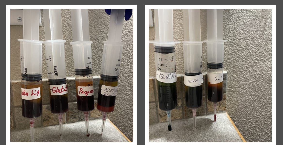 Rubbery Clot Development Observations In C19 Unvaccinated Blood With ...