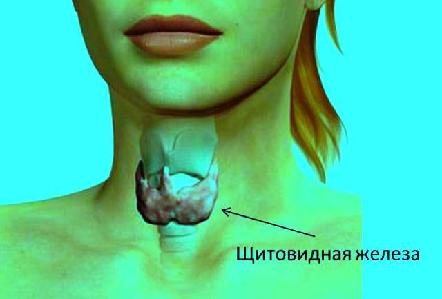 Tratamento do hipotireoidismo – três obstáculos