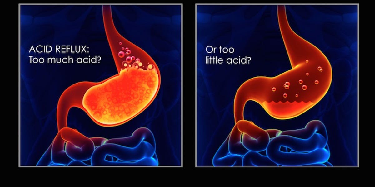 Stomach Acid Is Good For You - by A Midwestern Doctor