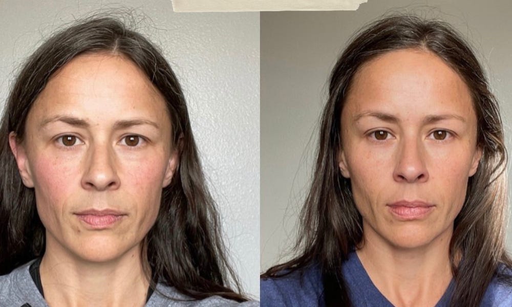 How I Changed The Shape Of My Face In 6 Weeks (without products or ...
