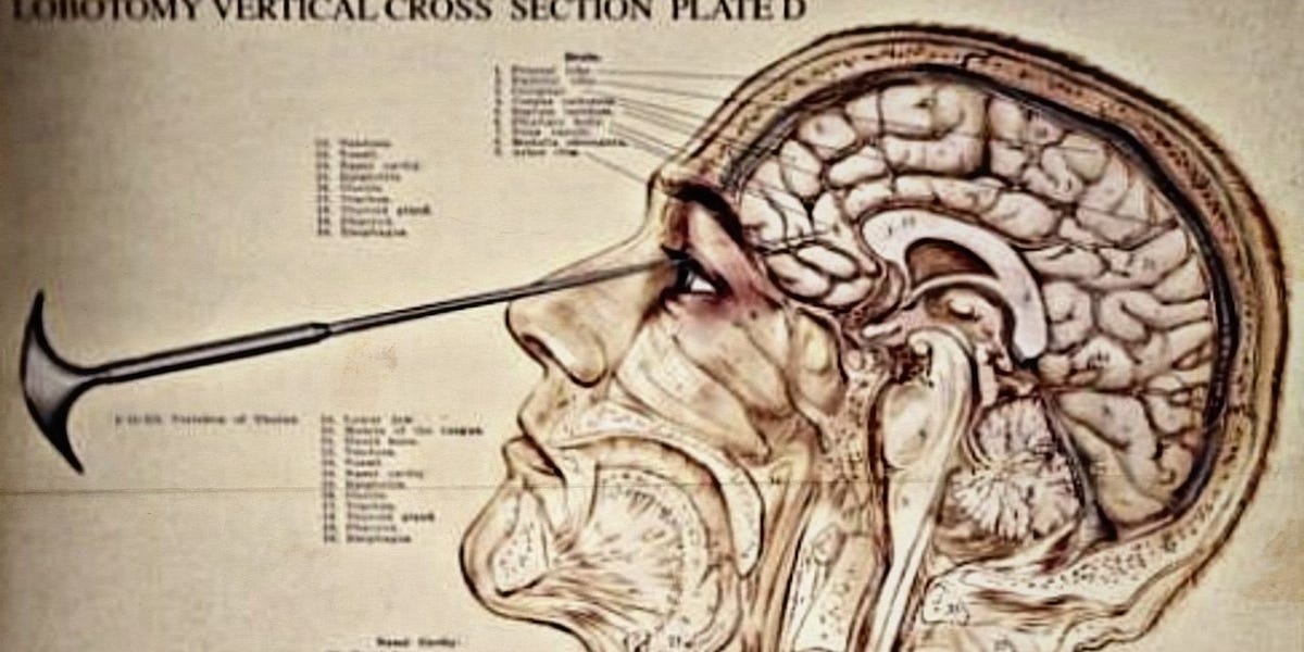 The Modern Day Lobotomy - by Torrance Stephens