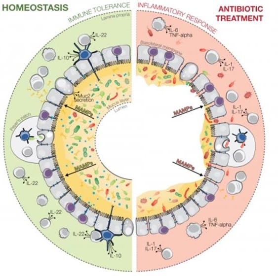 "Me duele la tripa constantemente". - by Alfredo Andreu