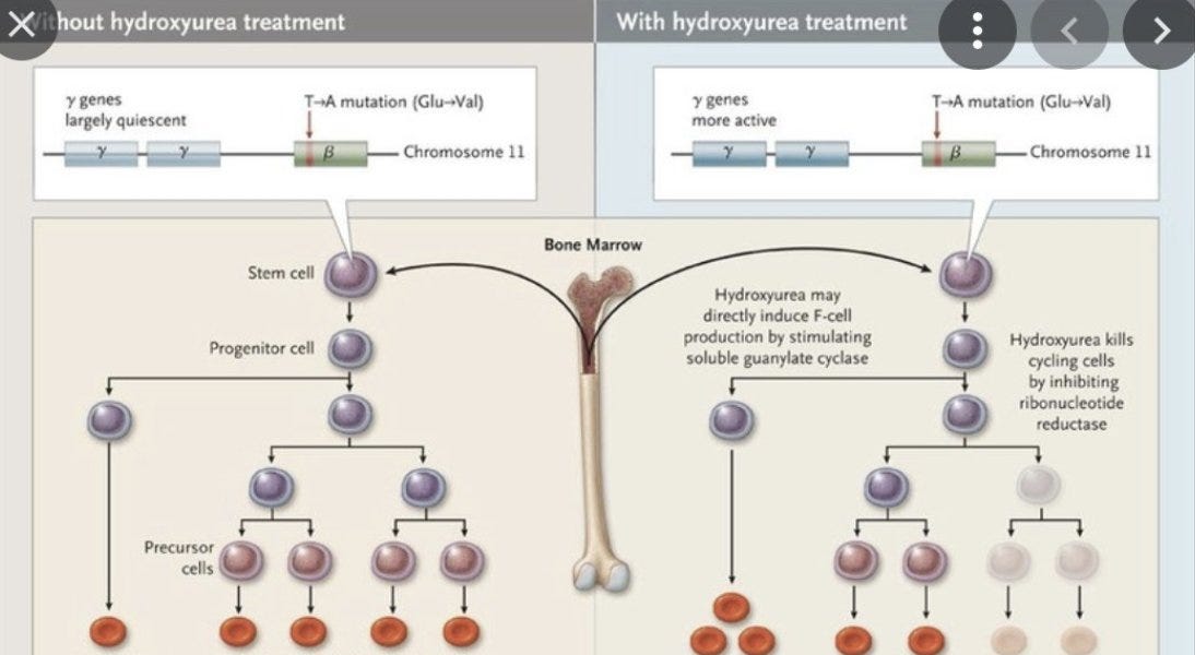 Hydroxyurea Sickle Cell Anemia!