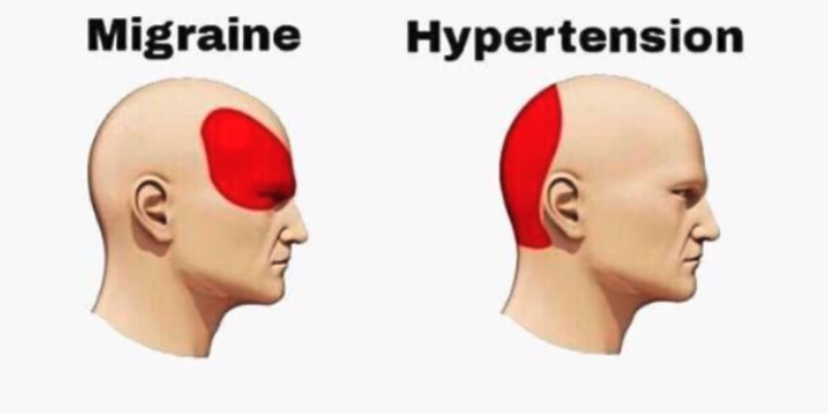 Solution To Sklearn Pipeline Custom Transformer Headache